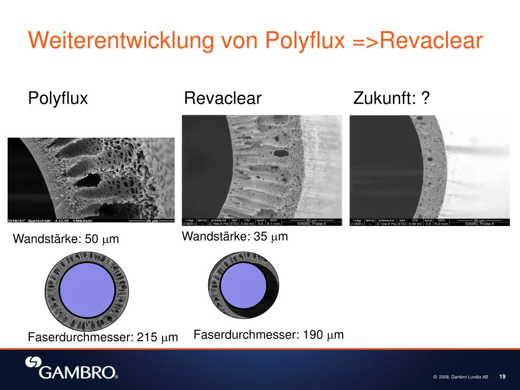 PPT - Neue Entwicklungen bei Dialysatoren Ein Beitrag zur Verbesserung ...