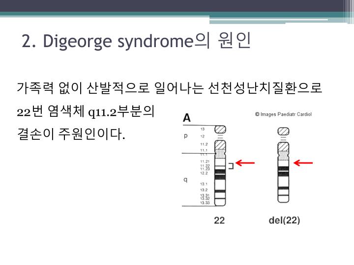 PPT - DiGeorge syndrome ( CATCH 22 ) PowerPoint Presentation - ID:3547561
