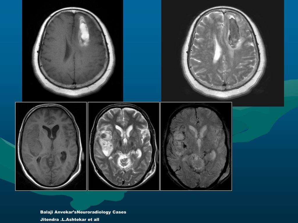 PPT - Aportul investigatiilor imagistice in examinarea pacientilor cu ...