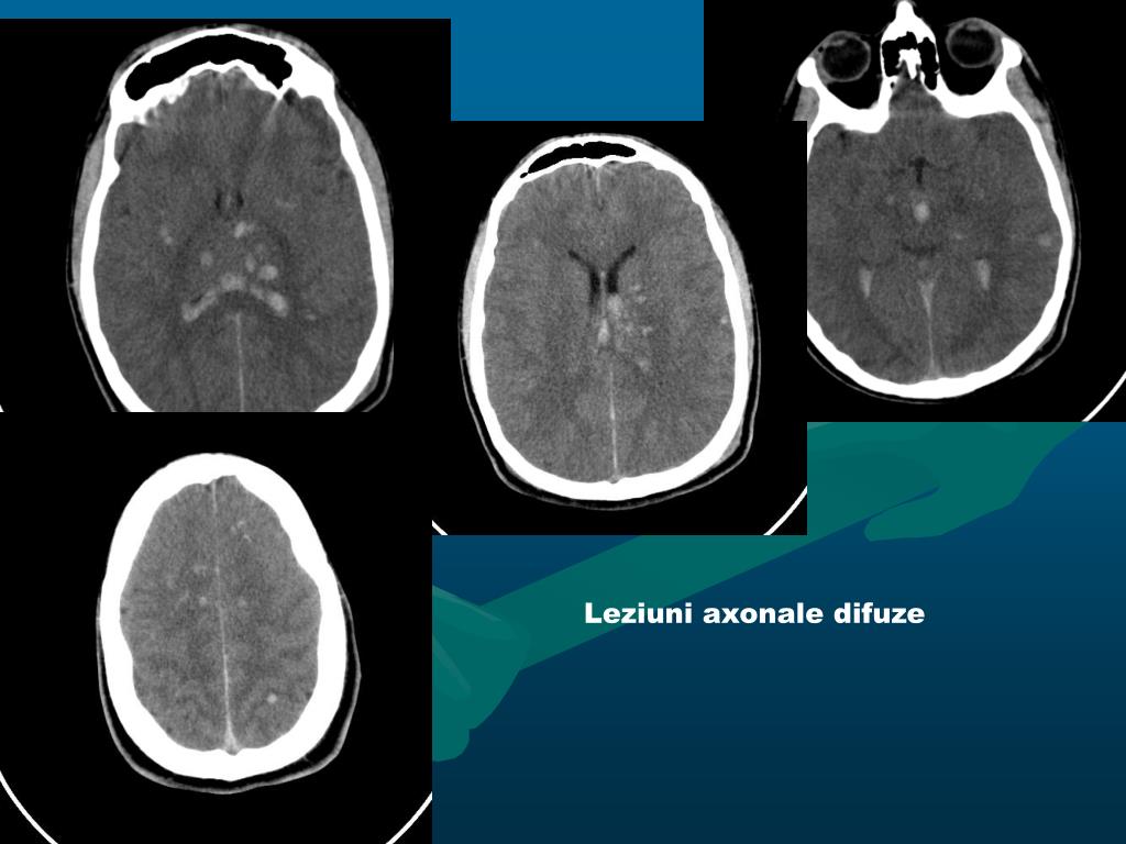 PPT - Aportul investigatiilor imagistice in examinarea pacientilor cu ...