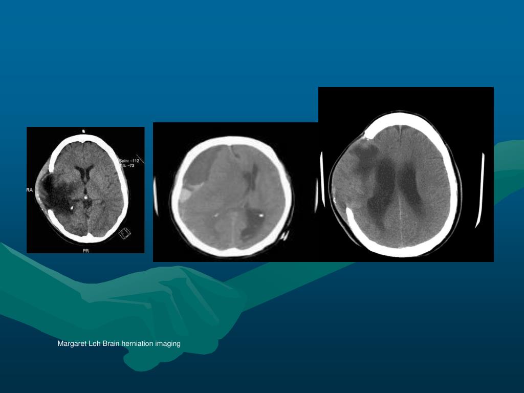 PPT - Aportul investigatiilor imagistice in examinarea pacientilor cu ...