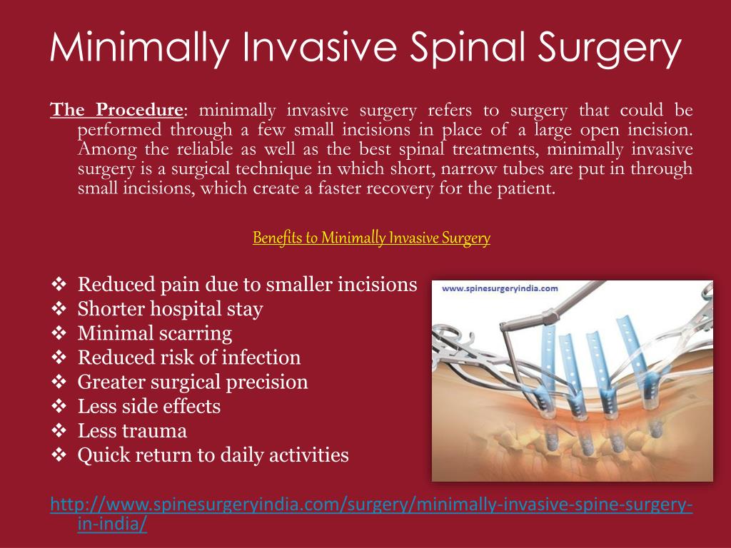 PPT - Low Cost Spine Surgery India PowerPoint Presentation, free ...