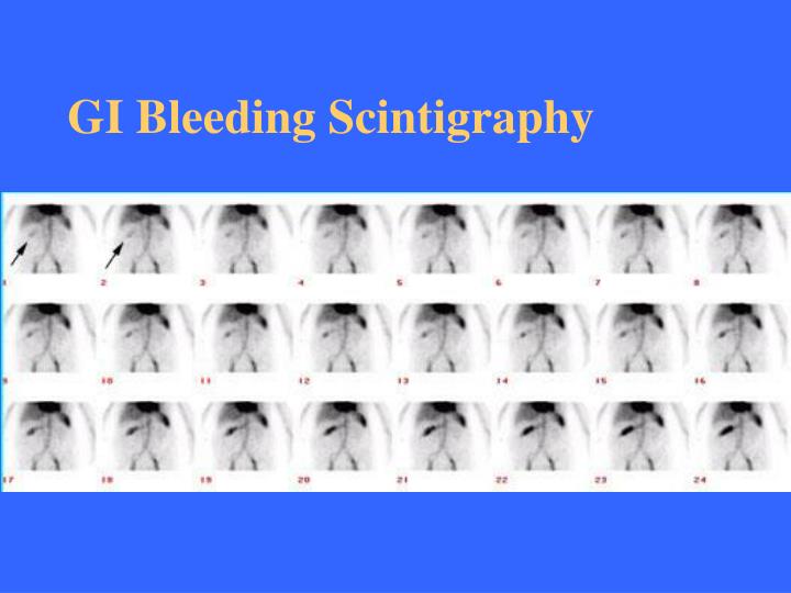 PPT - Nuclear Medicine in Gastrointestinal System PowerPoint ...