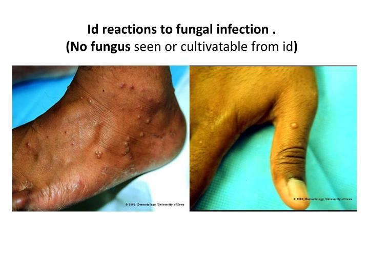 PPT - Struktur, Morfologi dan sifat pertumbuhan jamur PowerPoint ...