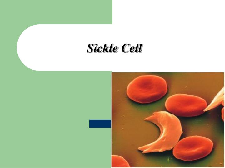PPT - Sickle Cell PowerPoint Presentation, free download - ID:3552776