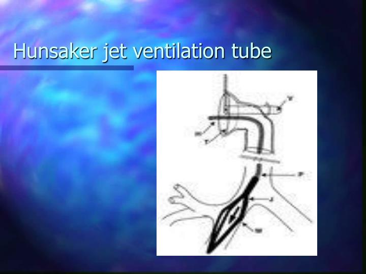 PPT - Application and Devices of Jet Ventilation PowerPoint ...