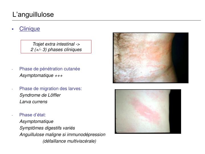 PPT - NEMATODOSES INTESTINALES PowerPoint Presentation - ID:3555866