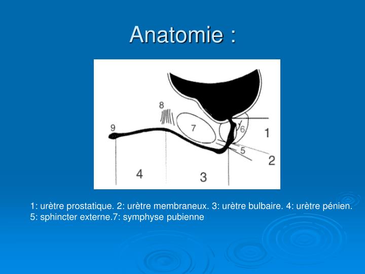 PPT - Les valves de l’urètre postérieur PowerPoint Presentation - ID ...