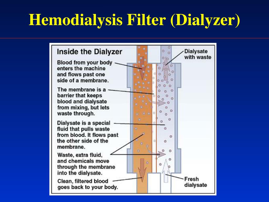 PPT - Renal Replacement Therapy – What the Non-Nephrologist Should Know ...
