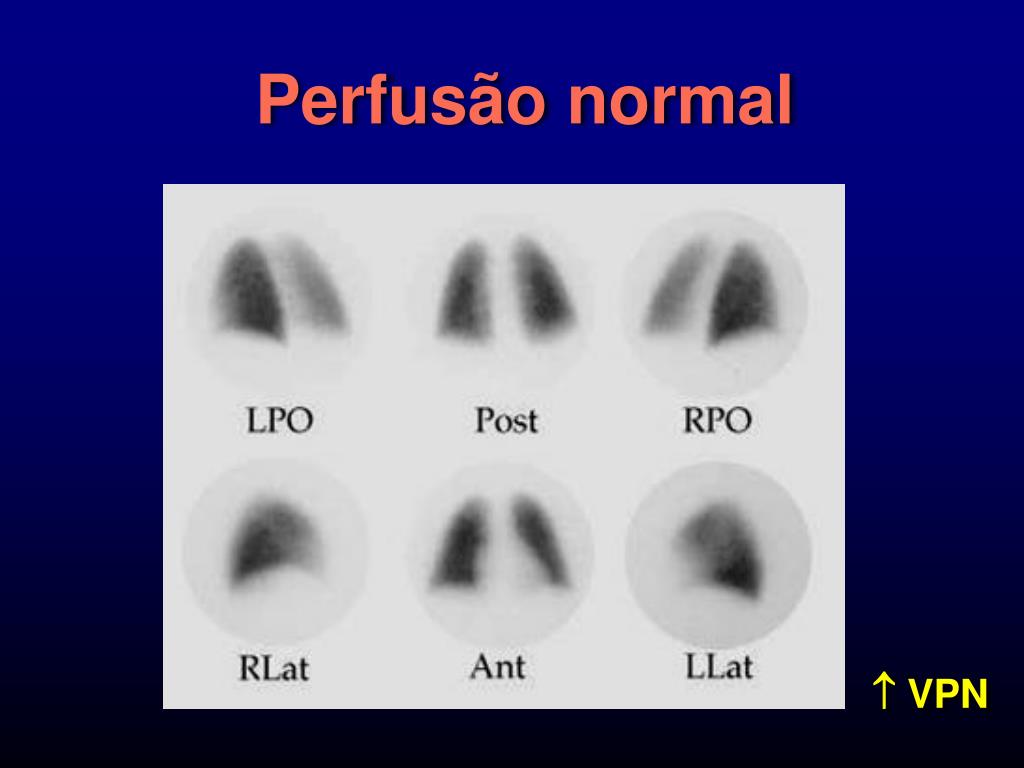 PPT - Métodos diagnósticos por imagens Medicina Nuclear PowerPoint ...
