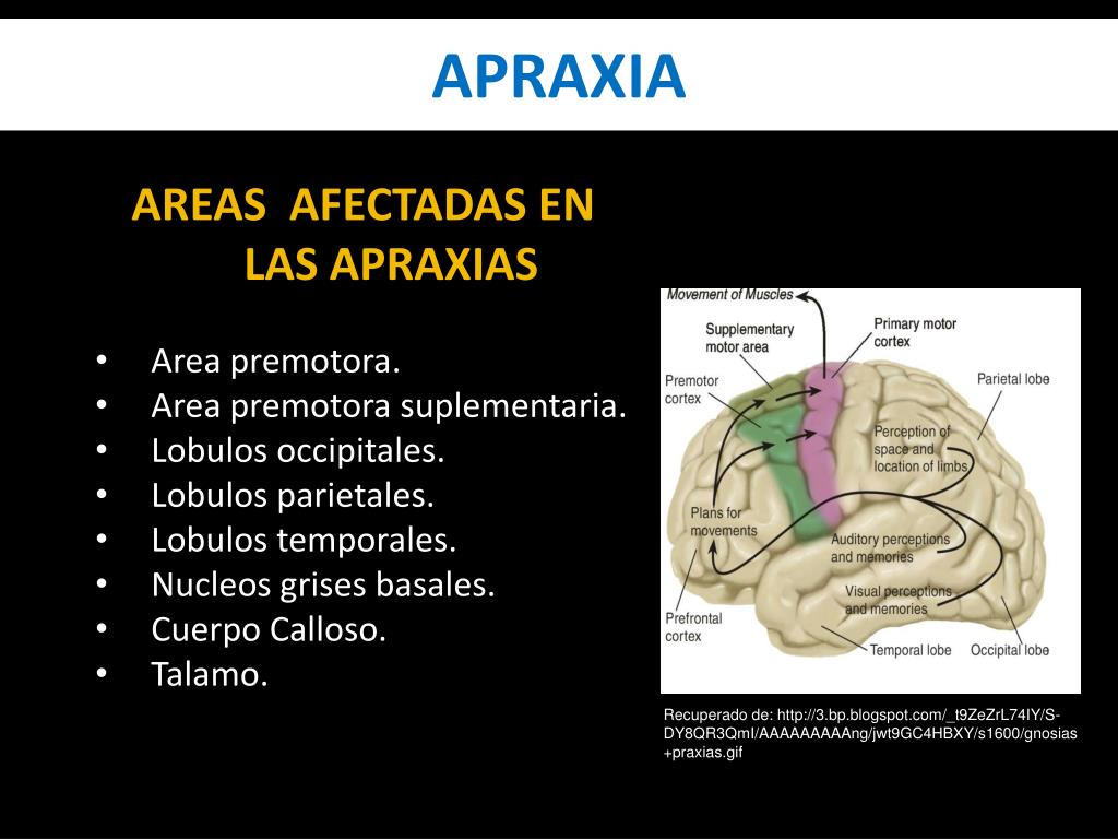 PPT - TRASTORNOS NEUROPSICOLOGICOS ADULTOS APRAXIAS PowerPoint ...