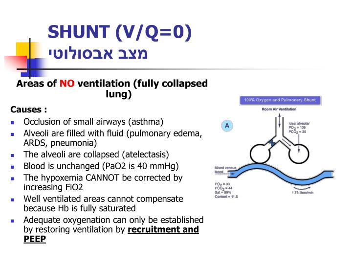 PPT - Respiratory Failure & Mechanical Ventilation PowerPoint ...