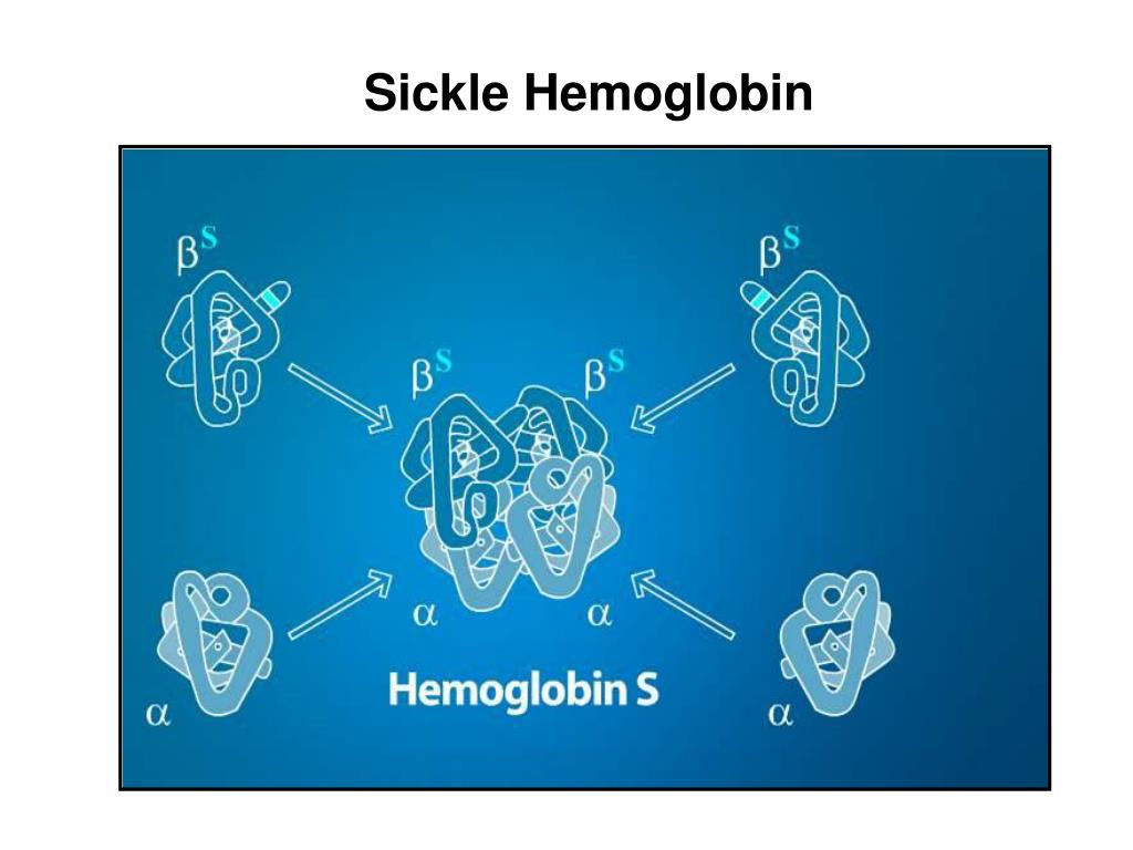 PPT - Sickle Cell Disease Research in the Genome Era PowerPoint ...