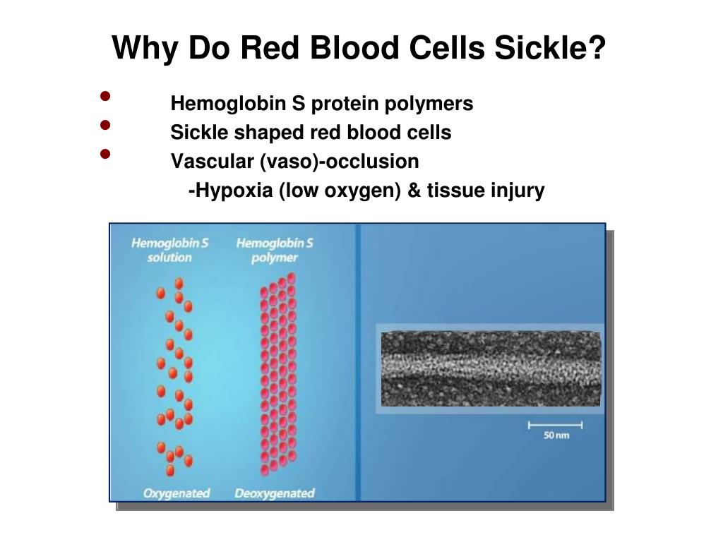 PPT - Sickle Cell Disease Research in the Genome Era PowerPoint ...
