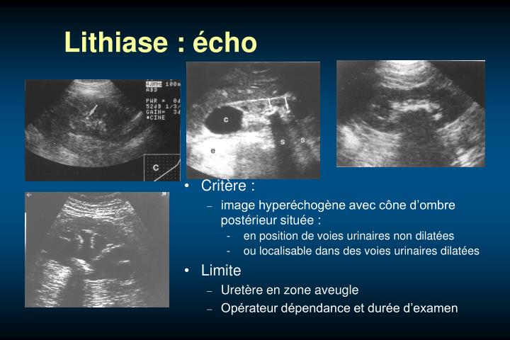 PPT - Sémiologie radiologique Appareil urinaire /génital masculin ...