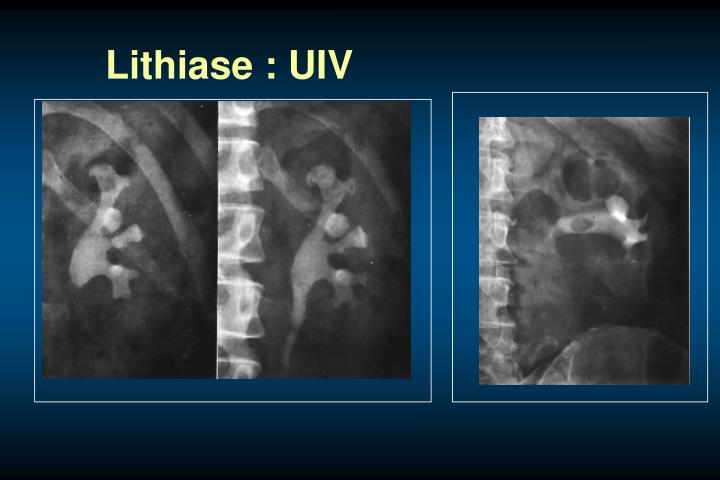 PPT - Sémiologie radiologique Appareil urinaire /génital masculin ...