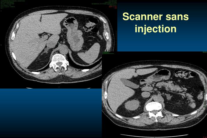 PPT - Sémiologie radiologique Appareil urinaire /génital masculin ...