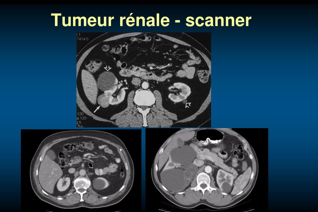 PPT - Sémiologie radiologique Appareil urinaire /génital masculin ...