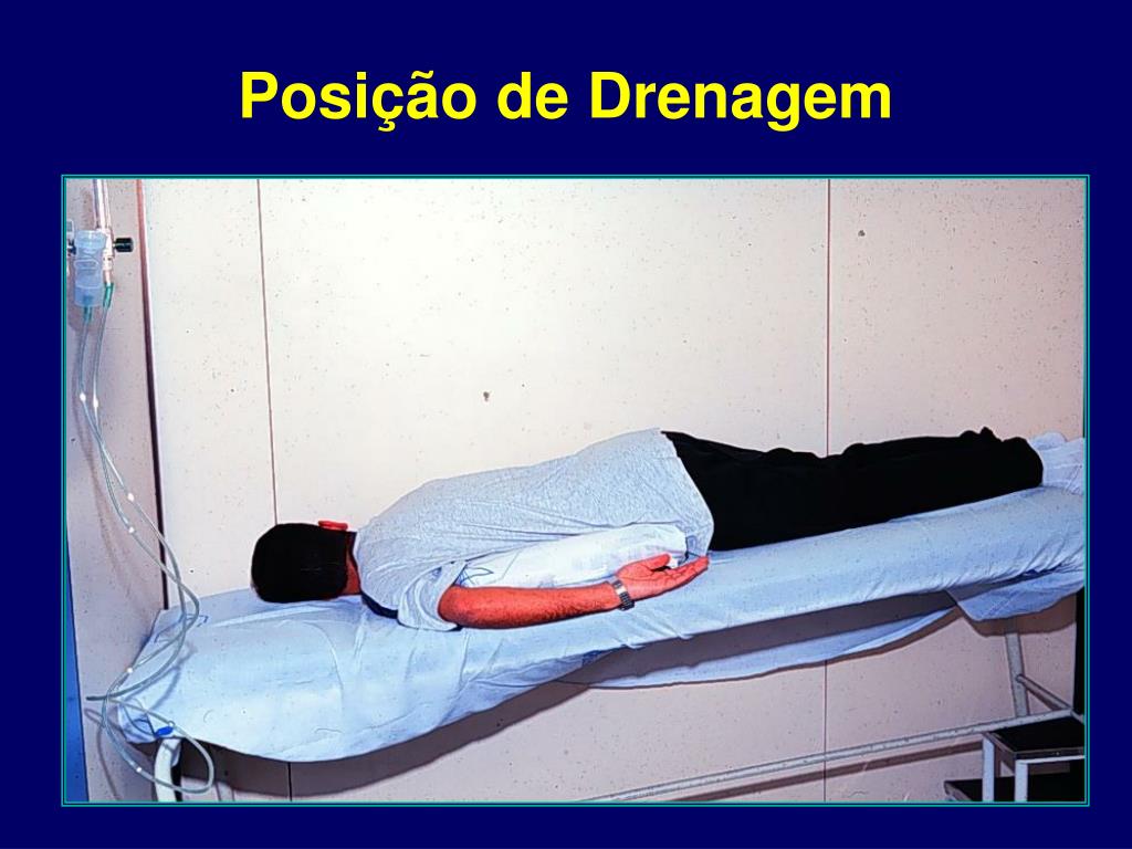 PPT - Reabilitação e Fisioterapia: Qual a diferença? José R. Jardim ...