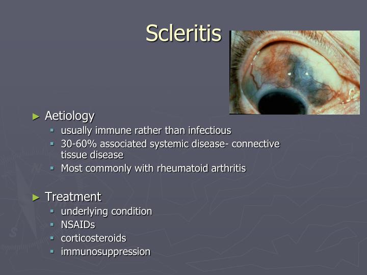 PPT - Acute Red Eye PowerPoint Presentation - ID:3564132