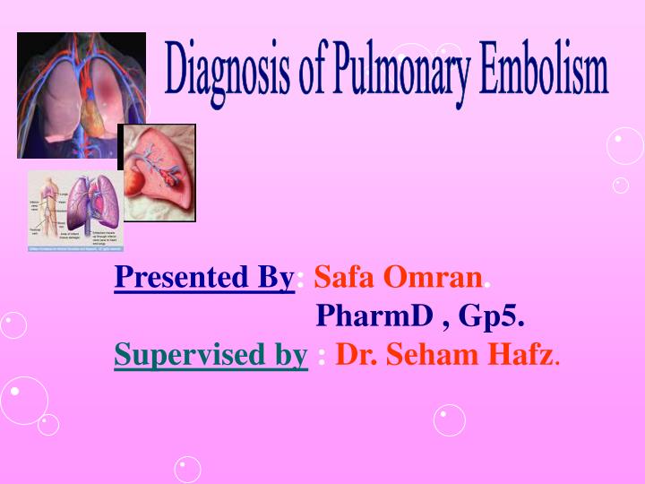 Ppt Diagnosis Of Pulmonary Embolism Powerpoint Presentation Free