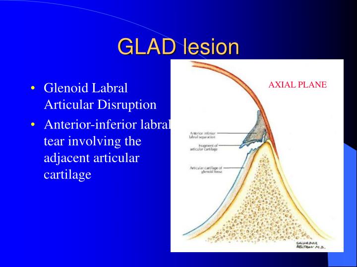 PPT - Shoulder Dyslexia: The Alphabet Soup Alison Nguyen 4/13/06 ...