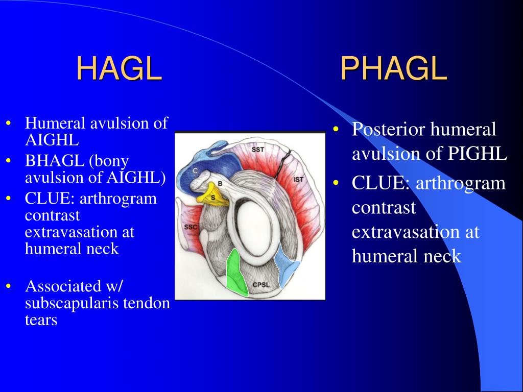 PPT - Shoulder Dyslexia: The Alphabet Soup Alison Nguyen 4/13/06 ...
