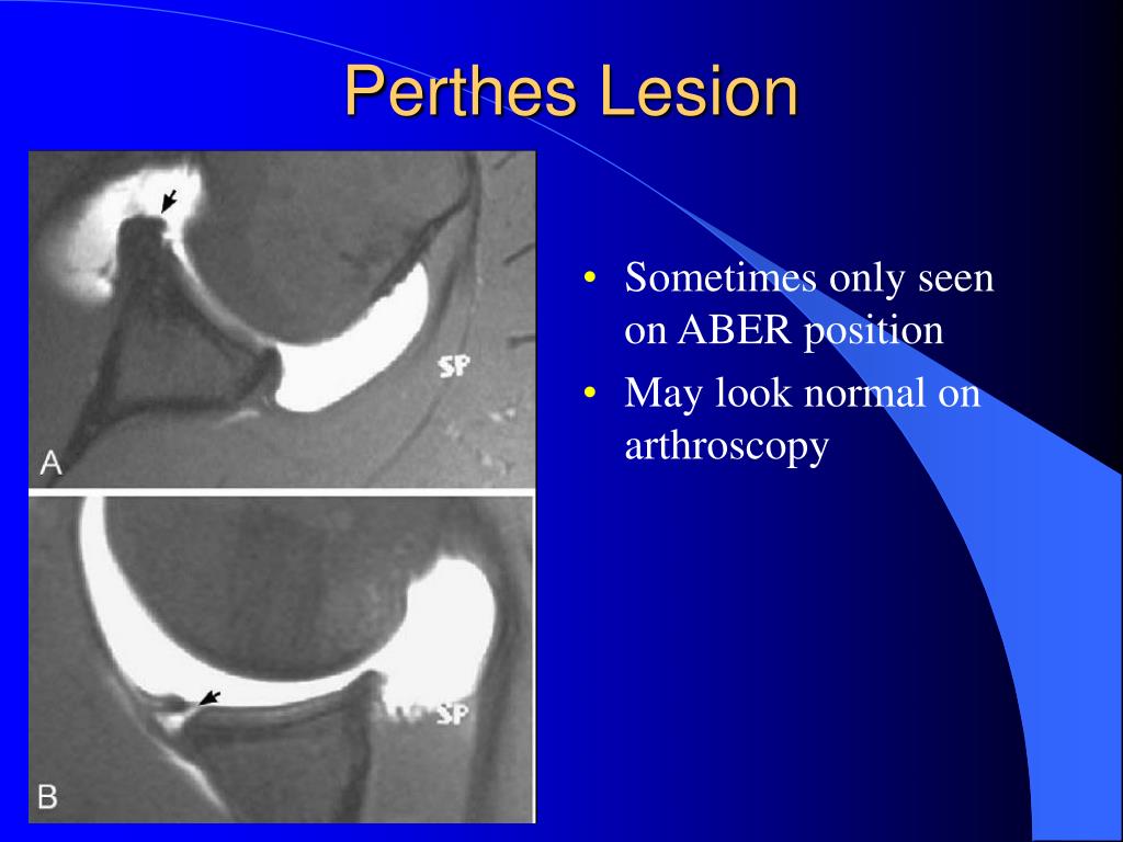 PPT - Shoulder Dyslexia: The Alphabet Soup Alison Nguyen 4/13/06 ...