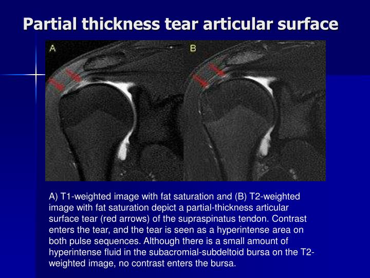 PPT - Werner Harmse July 2011 PowerPoint Presentation - ID:3565666