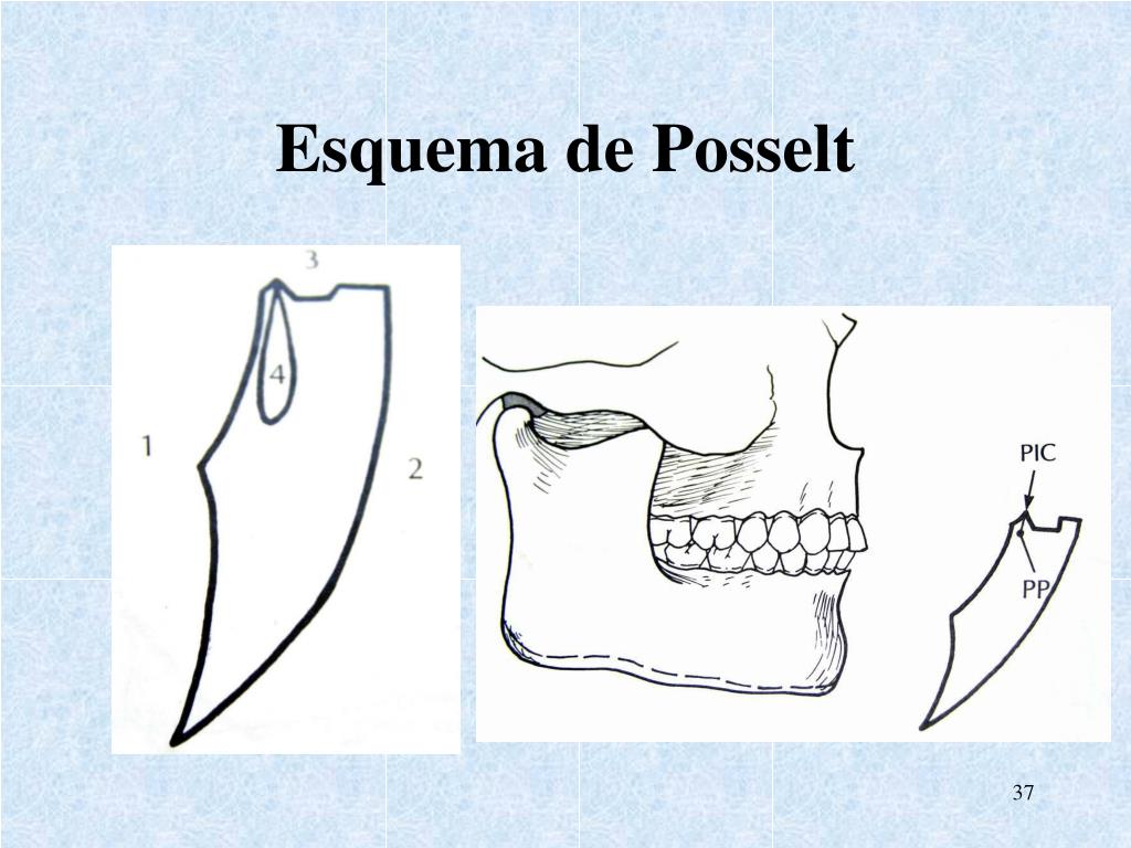 PPT - Cátedra Técnica de Prótesis UDA 2 “Introducción a la Prostodoncia ...