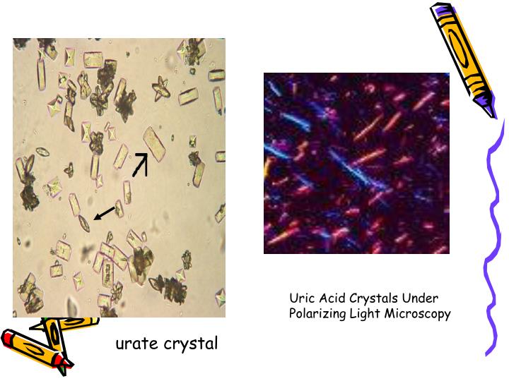 PPT - Uric acid PowerPoint Presentation - ID:3568648
