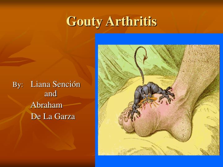 PPT - Gouty Arthritis PowerPoint Presentation, free download - ID:3568652