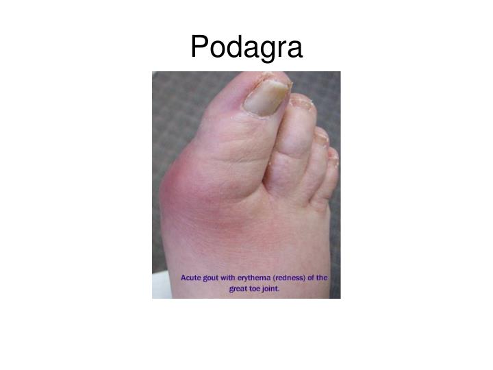 PPT - In the Clinic - Gout PowerPoint Presentation - ID:3569353