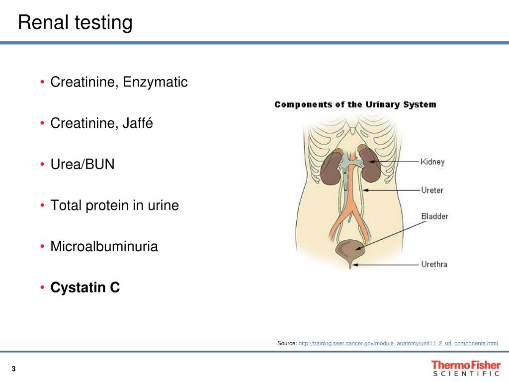 PPT - Cystatin C, Lipoprotein(a) and Ceruloplasmin in the Thermo ...