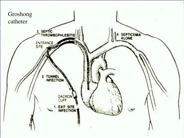 PPT - Nosocomial Infections PowerPoint Presentation - ID:3571640