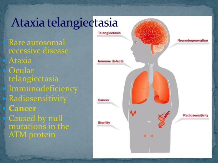PPT - Ataxia telangiectasia and the Role of ATM PowerPoint Presentation ...