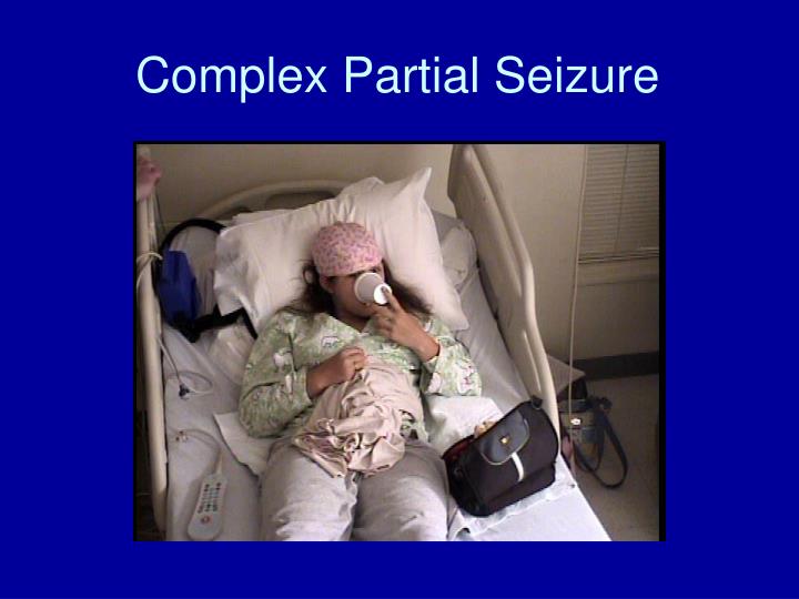 PPT - Pediatric Epilepsy: An Overview and Update on Treatment Options PowerPoint Presentation ...