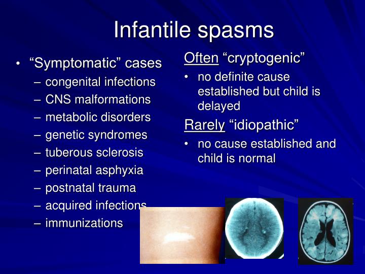 PPT - Pediatric Epilepsy: An Overview and Update on Treatment Options ...