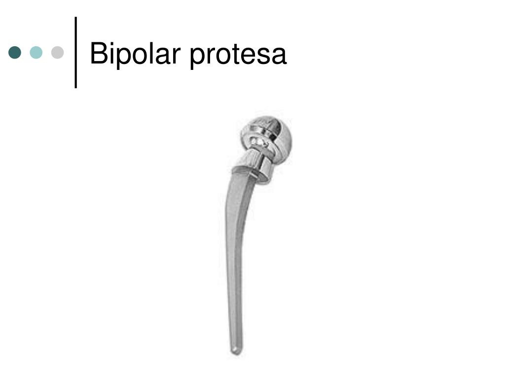 PPT - Meðferð beinbrota PowerPoint Presentation, free download - ID:3582705