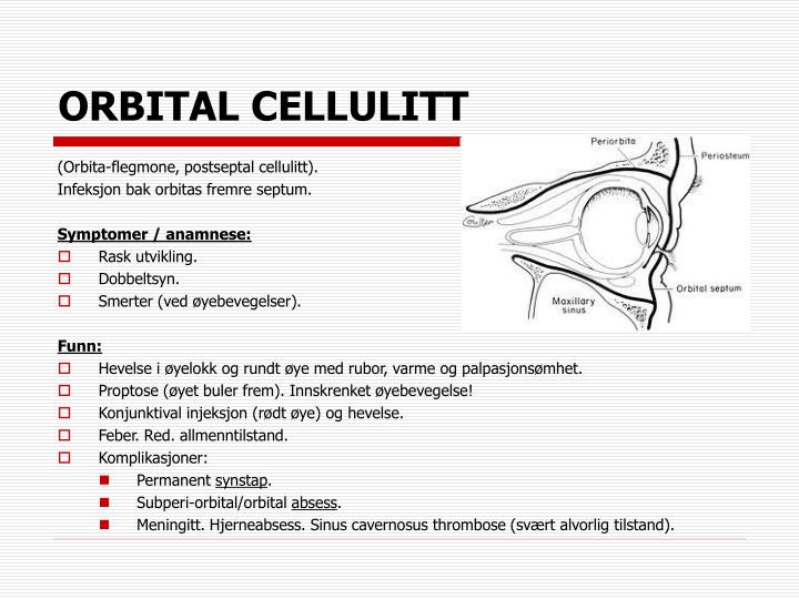 PPT - AKUTTE ØYELIDELSER PowerPoint Presentation - ID:3583402