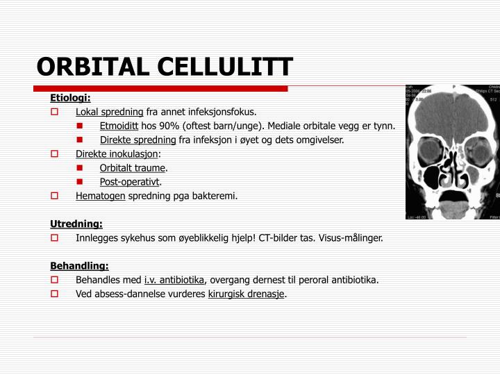 PPT - AKUTTE ØYELIDELSER PowerPoint Presentation - ID:3583402
