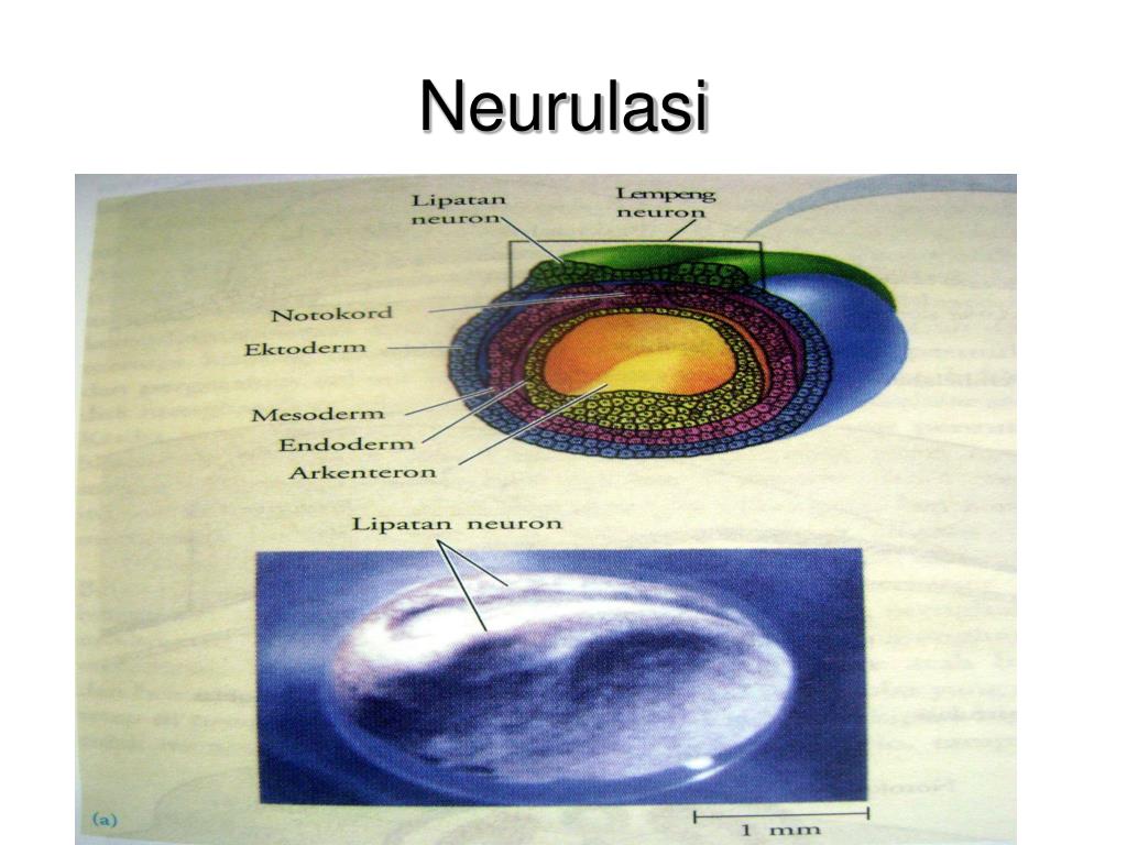 PPT - Organogenesis Awal- Neurulasi PowerPoint Presentation, free ...