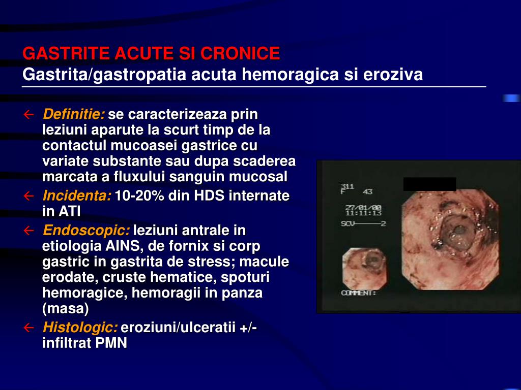 PPT - GASTRITE ACUTE SI CRONICE DEFINITIE, CLASIFICARE, DIAGNOSTIC SI ...