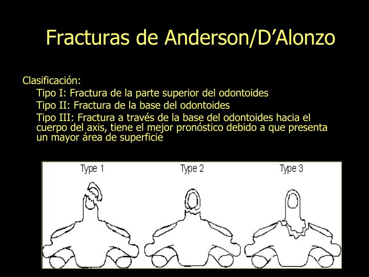 PPT - PATOLOGÍA TRAUMÁTICA DE COLUMNA Dr. Patricio Alegría Velis ...