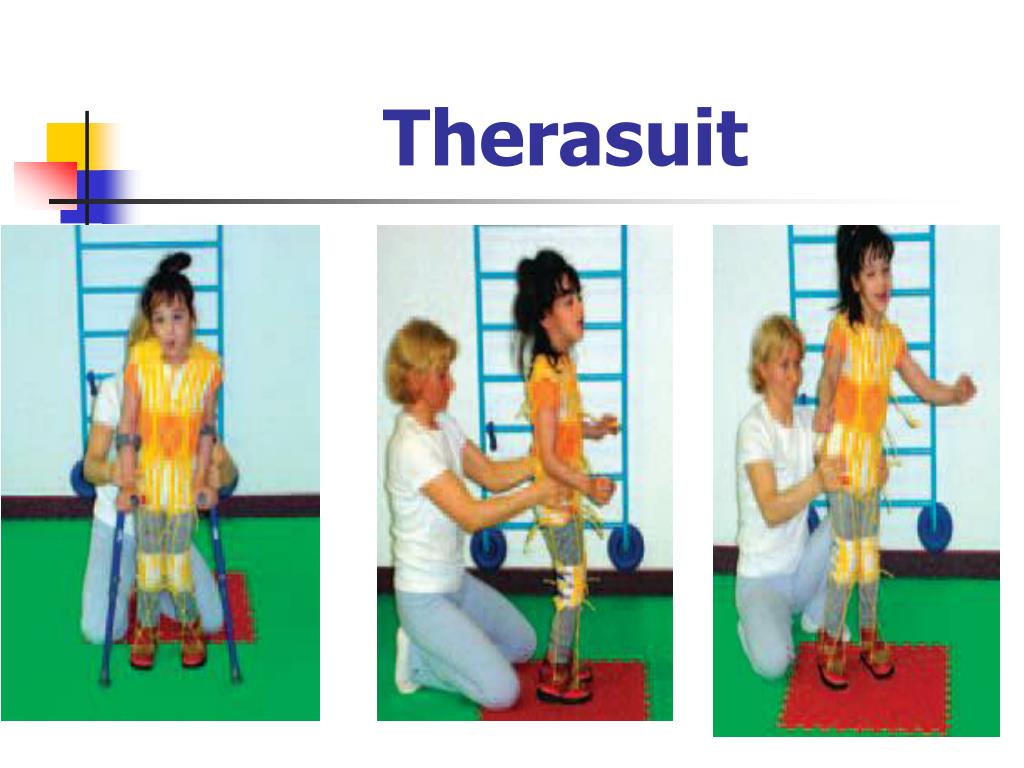 PPT - Management of Cerebral Palsy (Treatment) PowerPoint Presentation ...