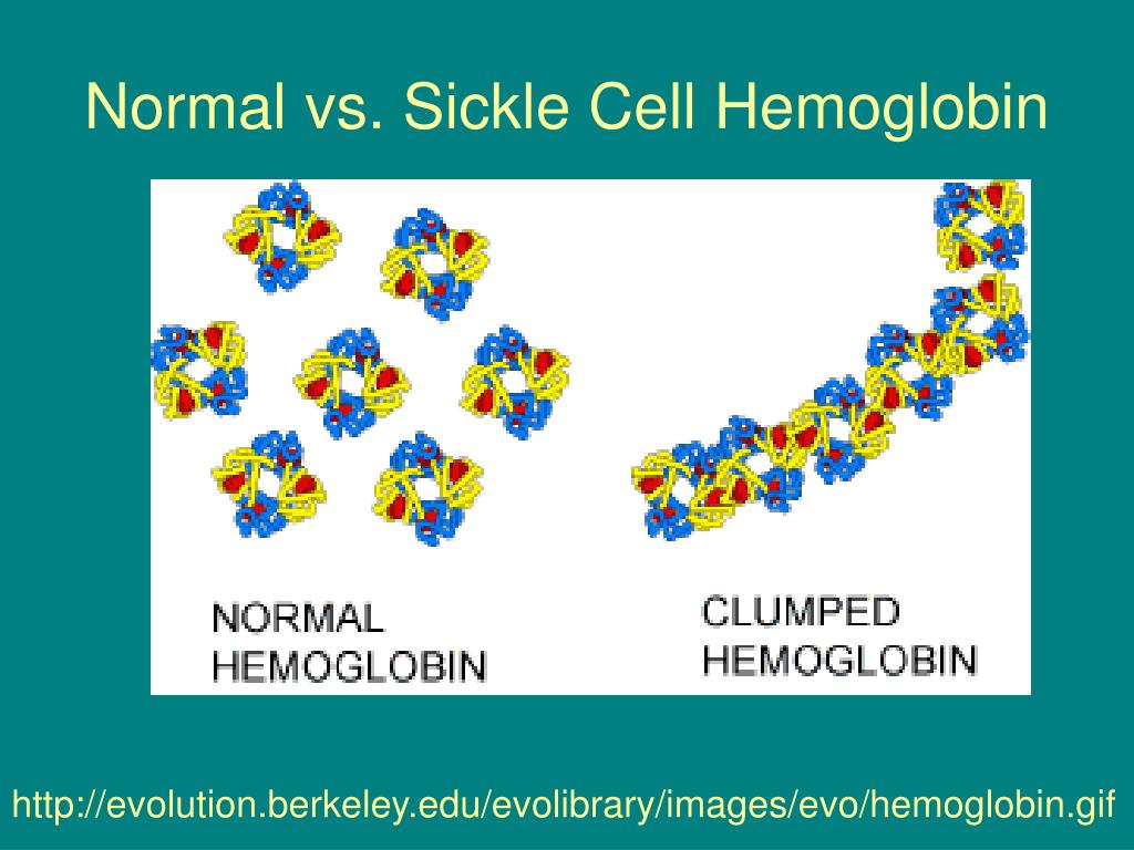 PPT - Genes Can Cause Disease: Sickle Cell Disease PowerPoint ...
