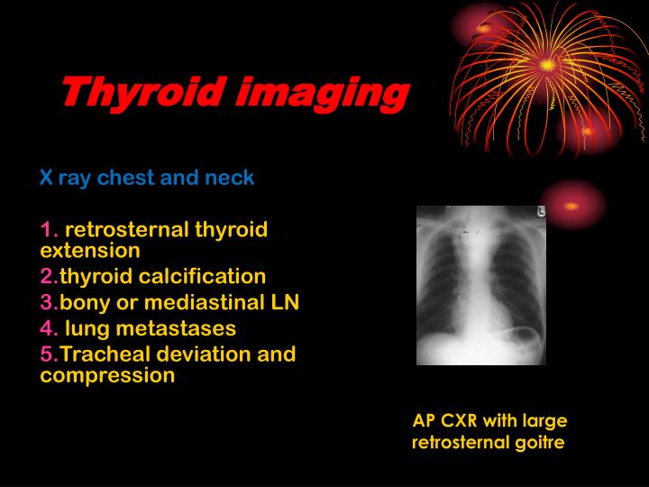 PPT - Solitary nodule of thyroid PowerPoint Presentation - ID:3594143