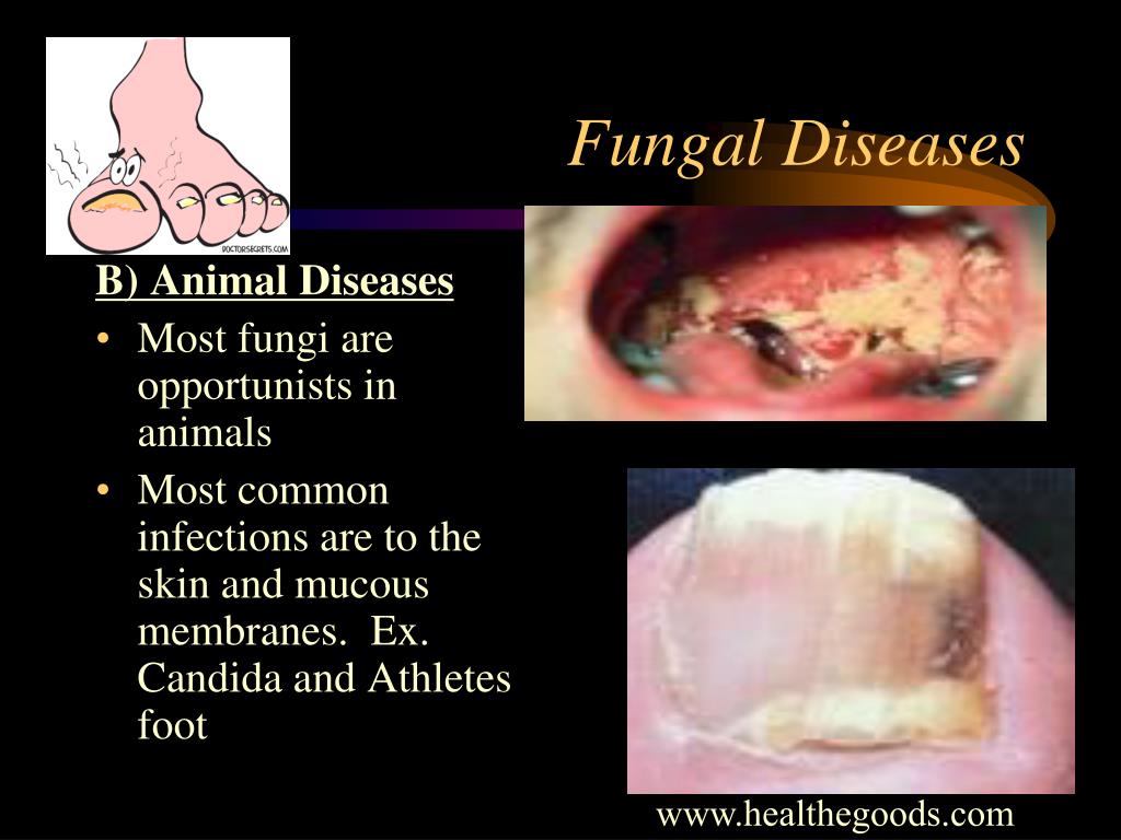 PPT - Fungus – Mycology-BIOLOGY 11 PowerPoint Presentation, free ...