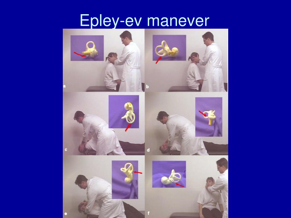 PPT - PONAVLJUJOČE POLOŽAJNE VRTOGLAVICE PowerPoint Presentation, free ...