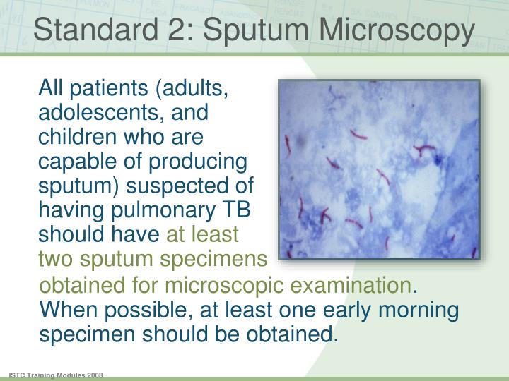 PPT - Clinical Presentation and Diagnosis of Tuberculosis PowerPoint ...